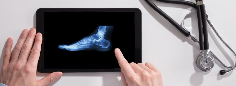 RTG stopy Lublin - 👉 CM Luxmed Lublin